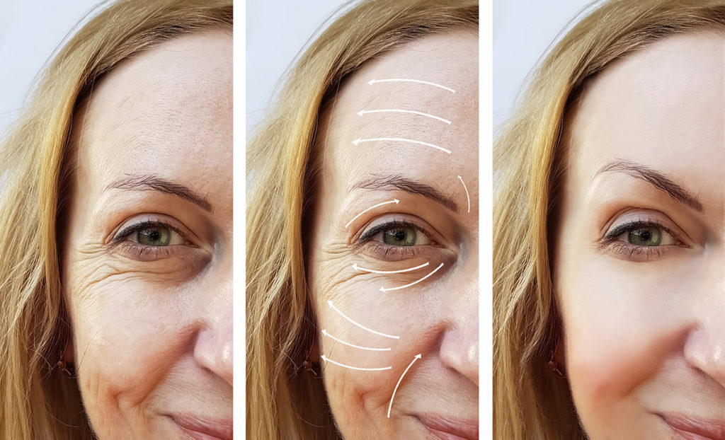 Wrinkles vs proportions and harmony